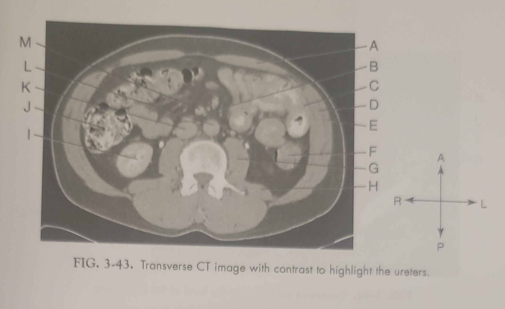 Solved FIG. 3-40. Transverse CT image through the splenic | Chegg.com