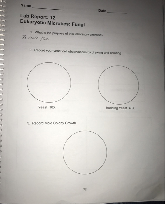 Solved Name Date Lab Report: 12 Eukaryotic Microbes: Fungi | Chegg.com Solved Name Date Lab Report: 12 Eukaryotic Microbes: Fungi | Chegg.com