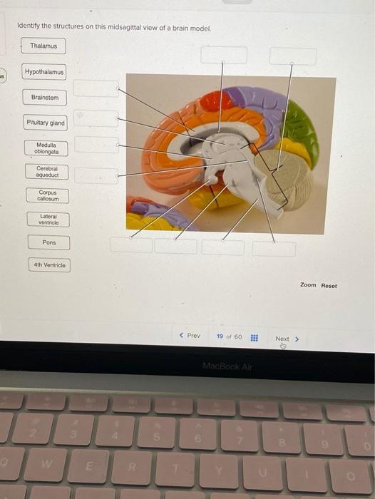 Solved Identify the structures on this midsagittal view of a | Chegg.com