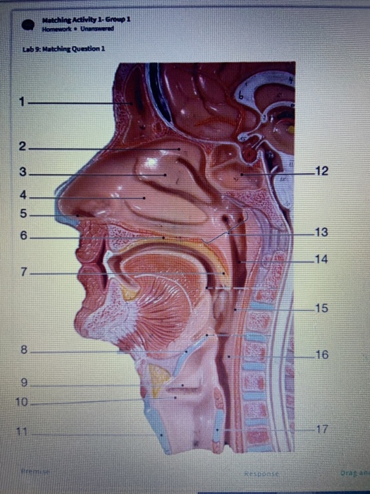 Solved a Matching Activity 1-Group 1 Homework. Unanswered | Chegg.com