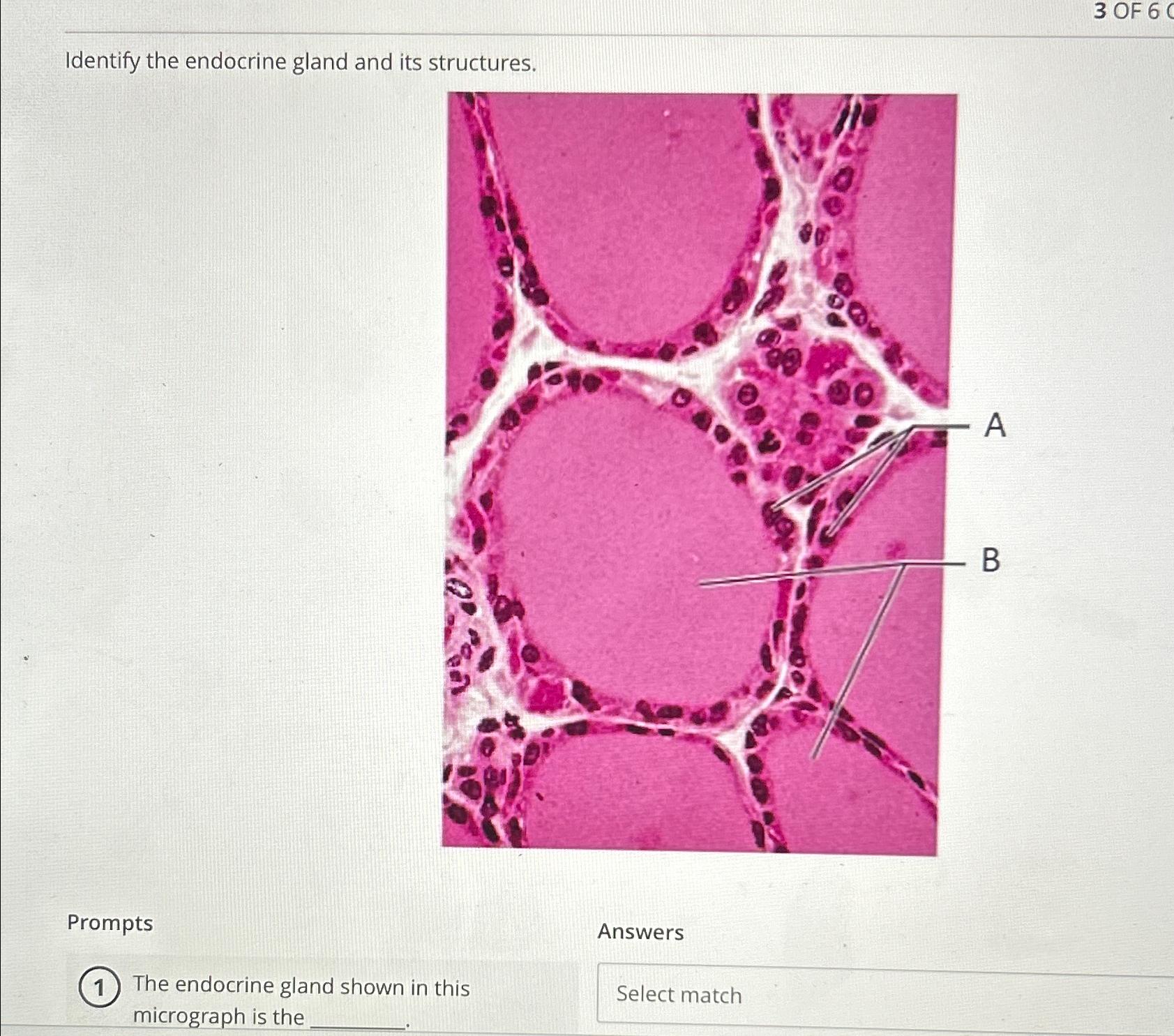 Solved 3 ﻿OF 6Identify the endocrine gland and its | Chegg.com