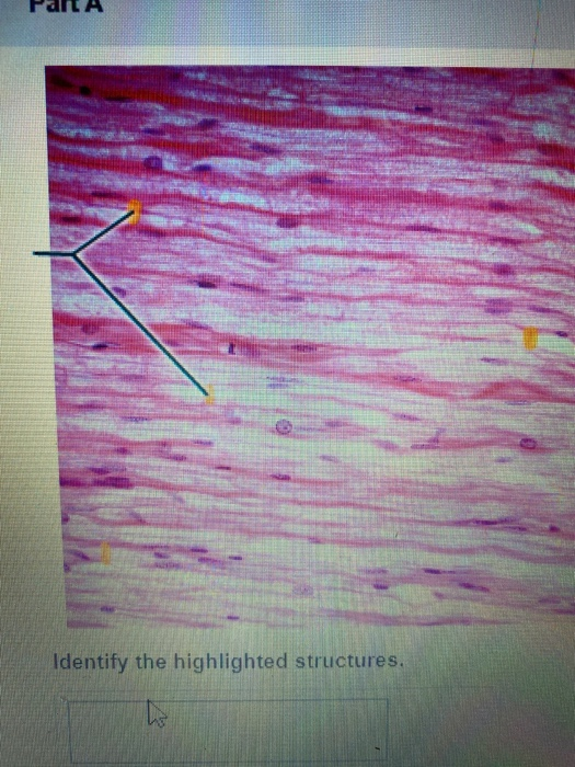 Solved Part A Identify the highlighted structures. Nervous | Chegg.com