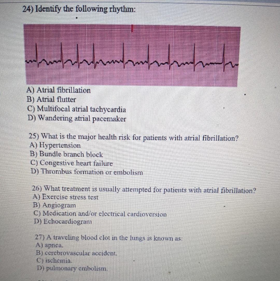 Solved 15) Identify the following rhythm: برابری میرا NANN | Chegg.com