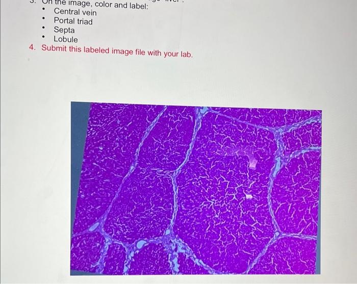 Solved label the histology of the liver by identifying | Chegg.com