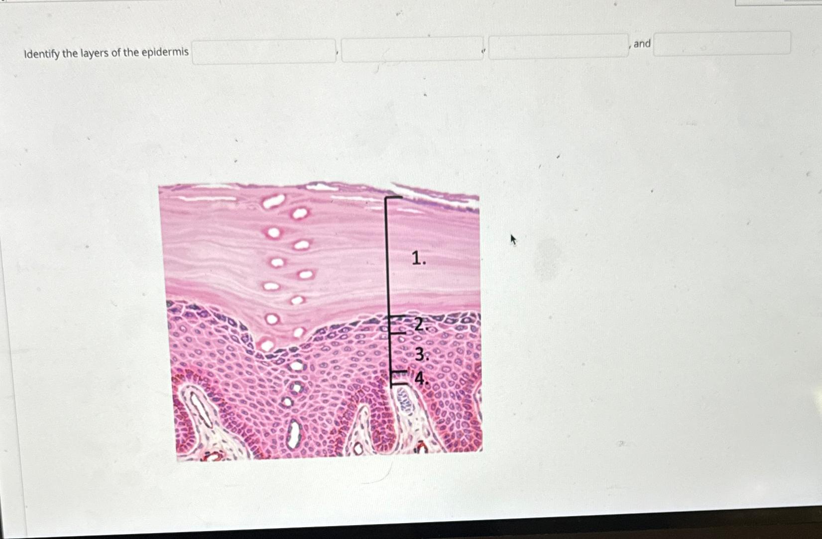 Solved Identify the layers of the epidermis and | Chegg.com