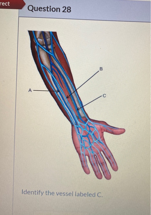 Solved Question 27 00 A Identify the vessel labeled B. | Chegg.com