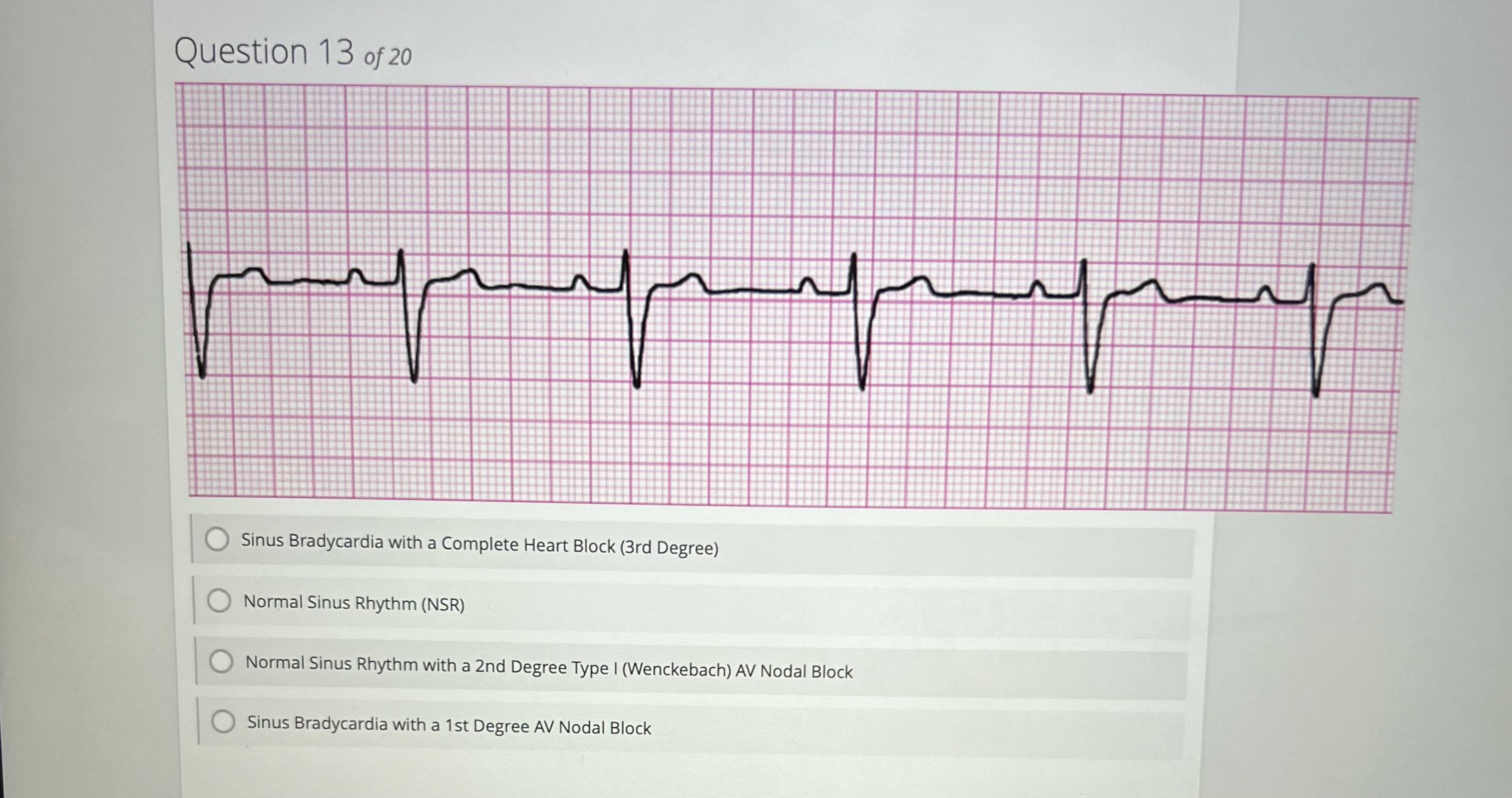 Question 13 ﻿of 20Sinus Bradycardia with a Complete | Chegg.com