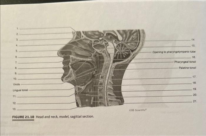 FIGURE 21.10 Head and neck, model, sagittal section. | Chegg.com