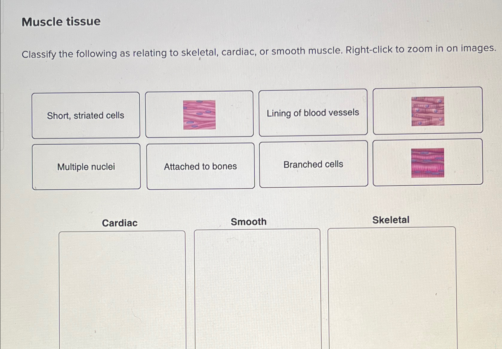 Solved Muscle tissueClassify the following as relating to | Chegg.com
