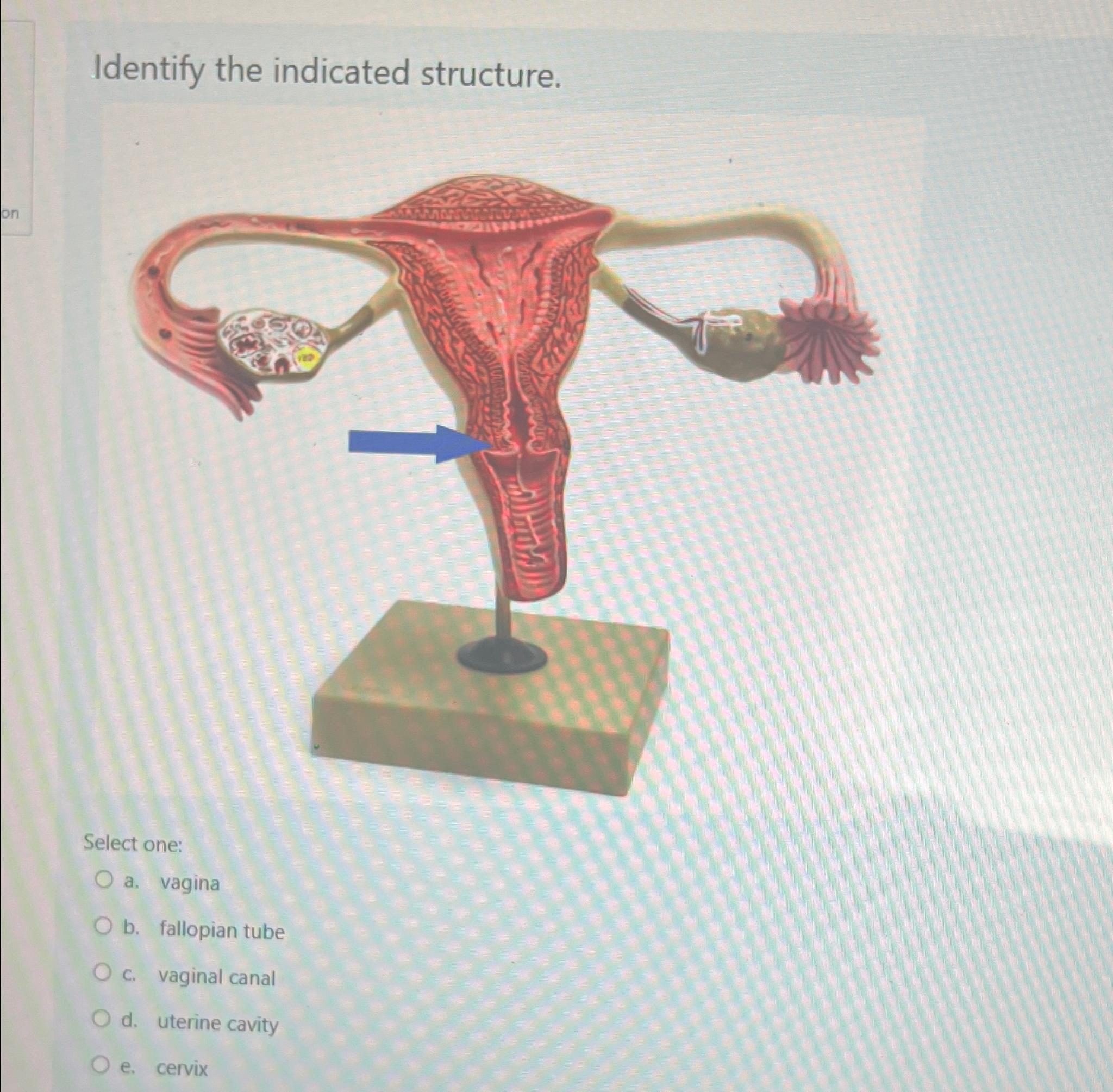 Identify the indicated structure.Select one:a. | Chegg.com