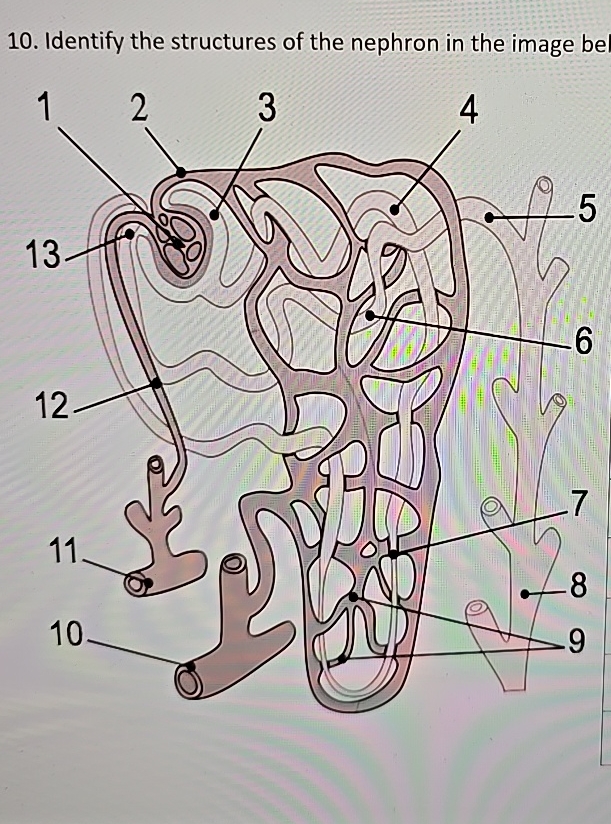 Solved Identify the structures of the nephron in the image | Chegg.com