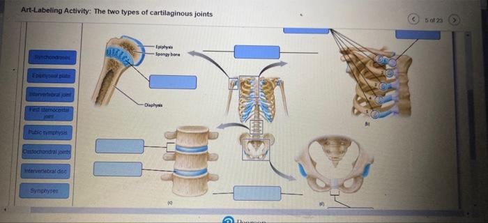 Solved Art-Labeling Activity: The two types of cartilaginous | Chegg.com