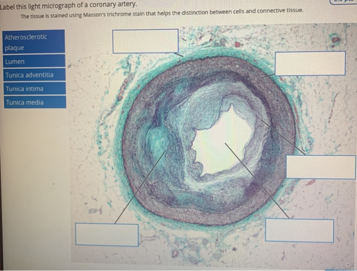 Solved Label this light micrograph of a coronary artery. The | Chegg.com