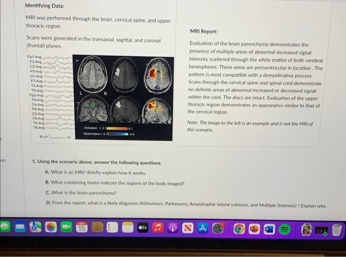 Solved Identifying Data: MRI was performed through the | Chegg.com