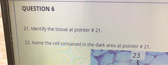 Solved QUESTION 6 21. Identify the tissue at pointer # 21. | Chegg.com