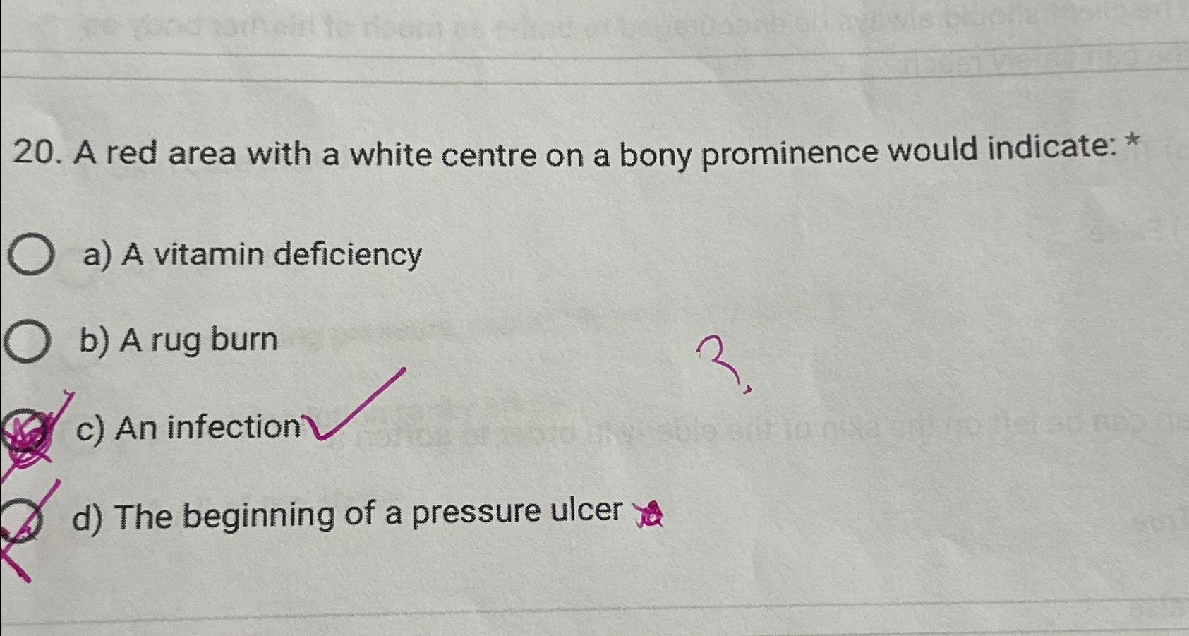 Solved A red area with a white centre on a bony prominence | Chegg.com