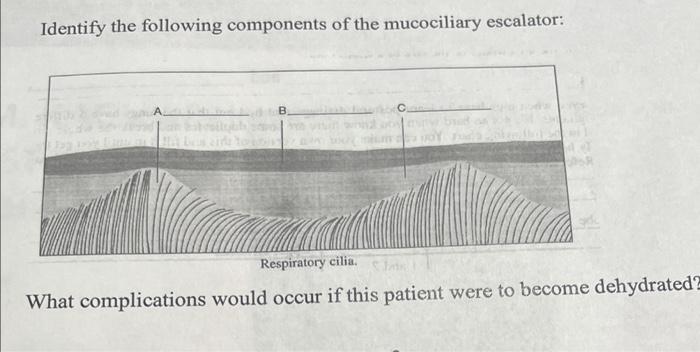 Solved Identify the following components of the mucociliary | Chegg.com