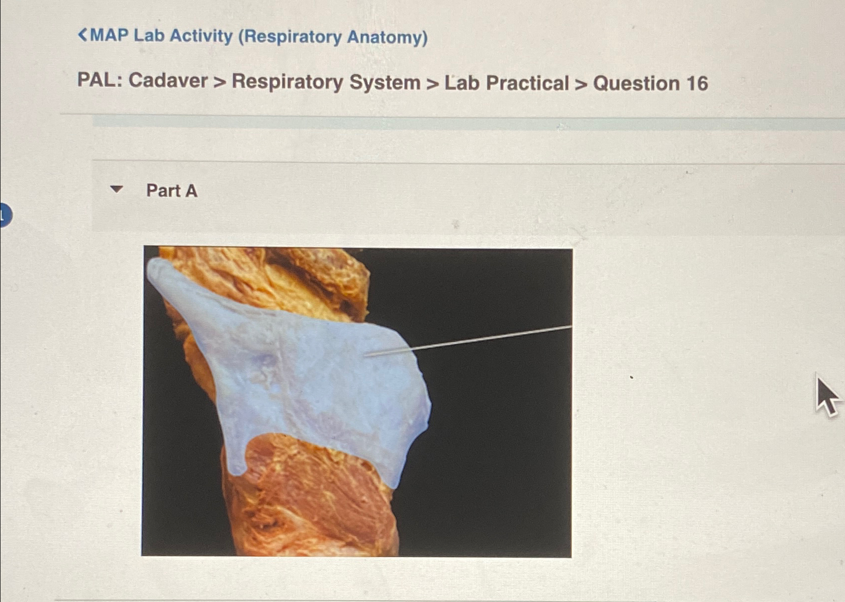 MAP Lab Activity (Respiratory Anatomy) PAL: Cadaver | Chegg.com MAP Lab Activity (Respiratory Anatomy) PAL: Cadaver | Chegg.com