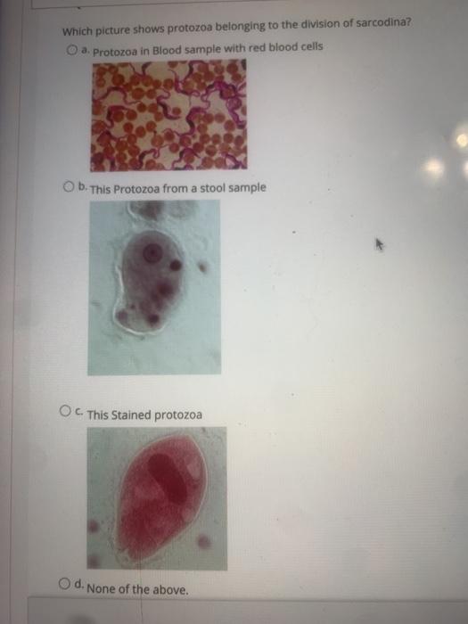 Solved QUESTION 30 Protozoa in this photo of red blood cells | Chegg.com
