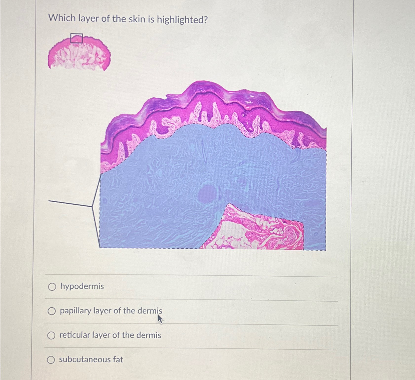 Solved Which layer of the skin is | Chegg.com