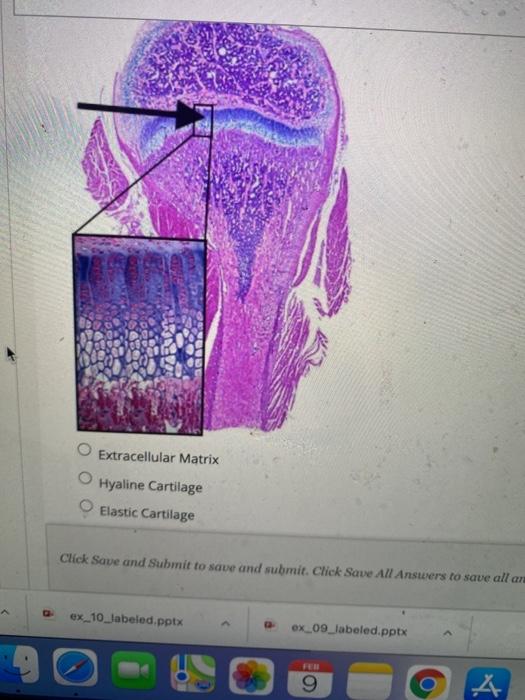 Solved Extracellular Matrix O Hyaline Cartilage Elastic | Chegg.com