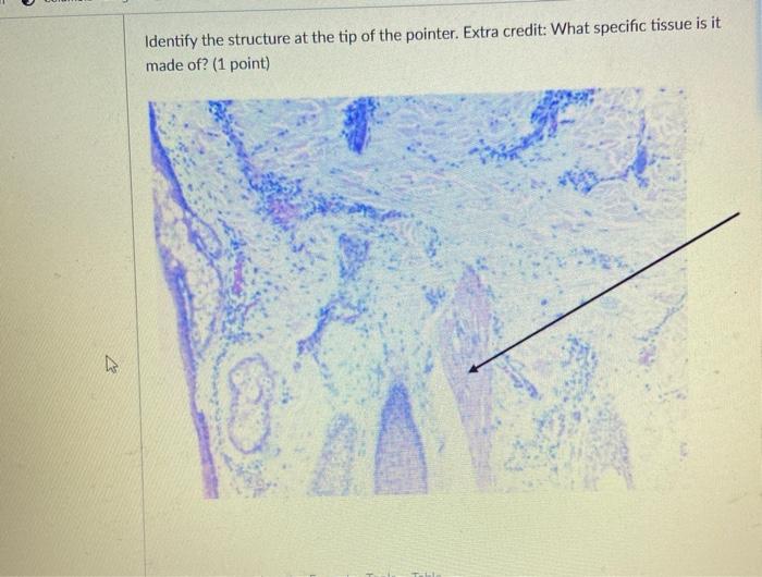 Solved Identify the structure at the tip of the pointer. | Chegg.com