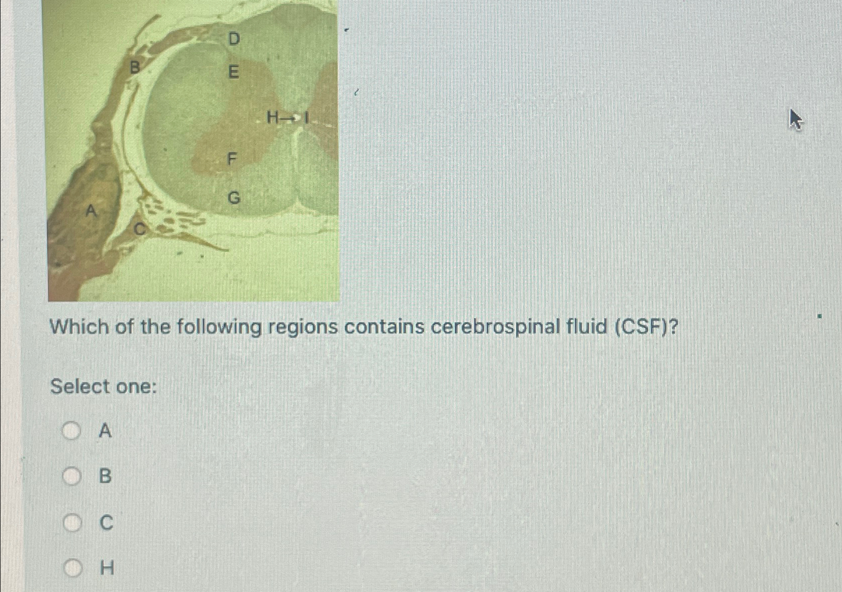 Solved Which of the following regions contains cerebrospinal | Chegg.com