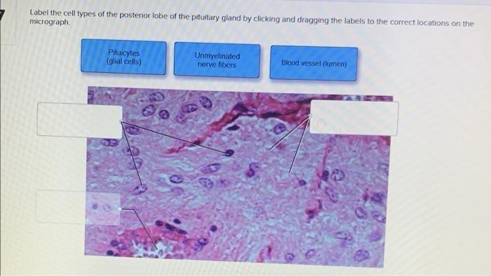 Solved Label the cell types of the posterior lobe of the | Chegg.com