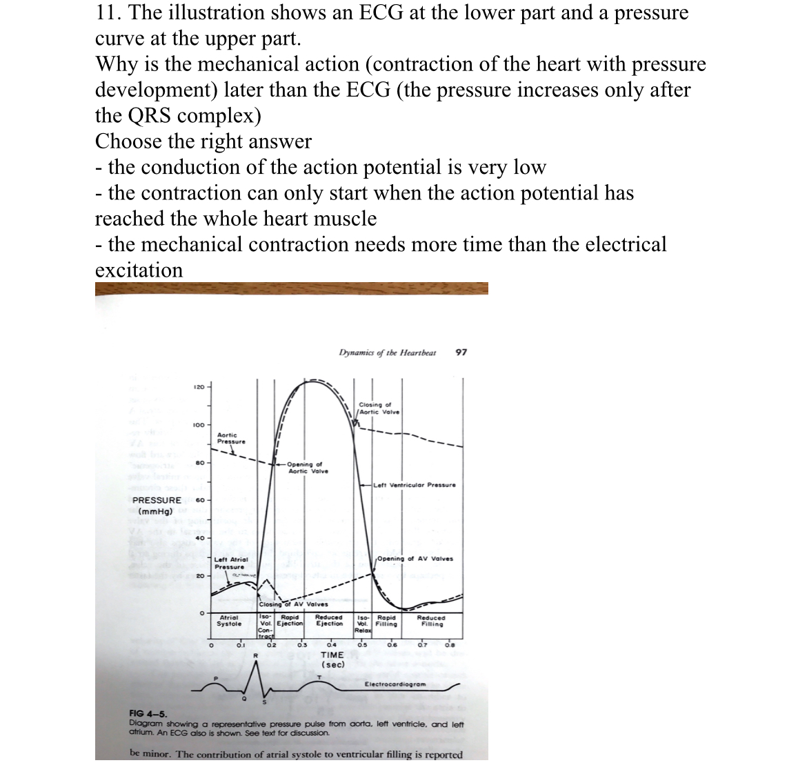 Solved The illustration shows an ECG at the lower part and a | Chegg.com