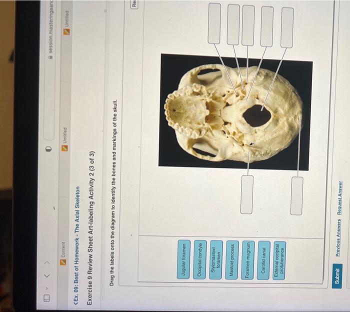 Solved session.masteringaanc Untitied Untided Untived 〈Ex. | Chegg.com