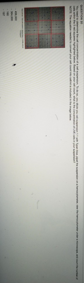 Solved i ng whether NGF (select ALL correct answer QUESTION | Chegg.com