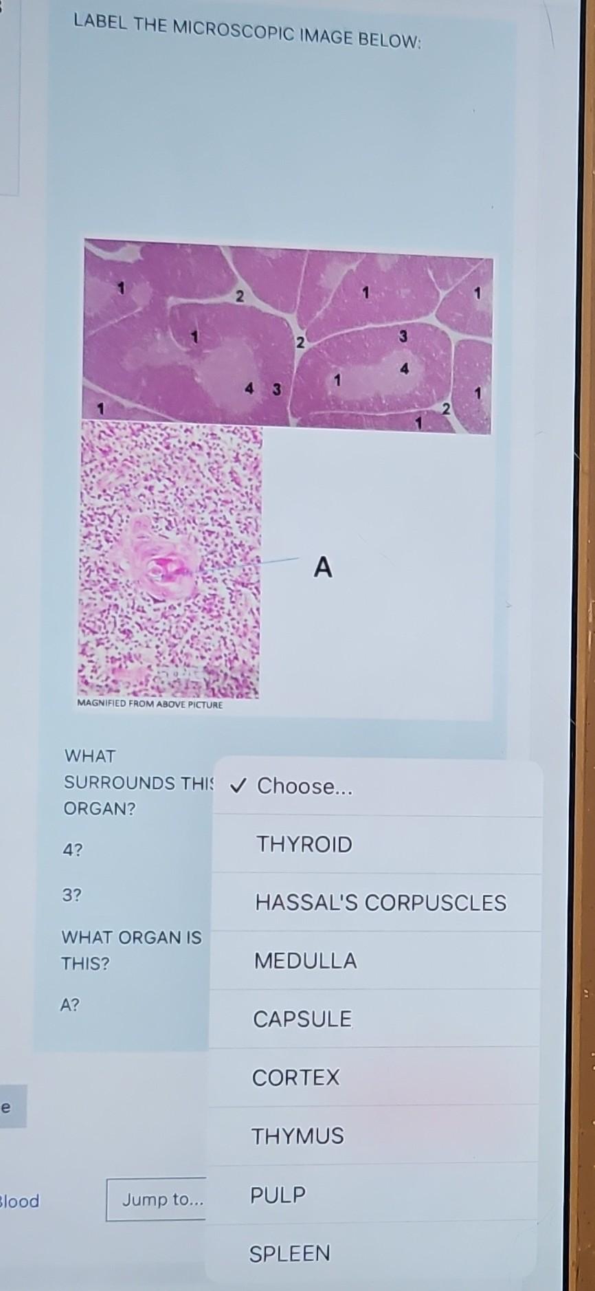 Solved LABEL THE MICROSCOPIC IMAGE BELOW: | Chegg.com