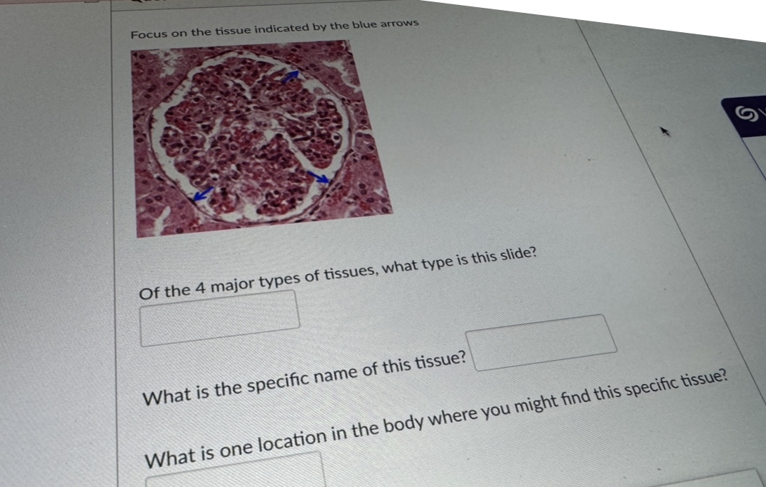 Solved Of the 4 ﻿major types of tissues, what type is this | Chegg.com