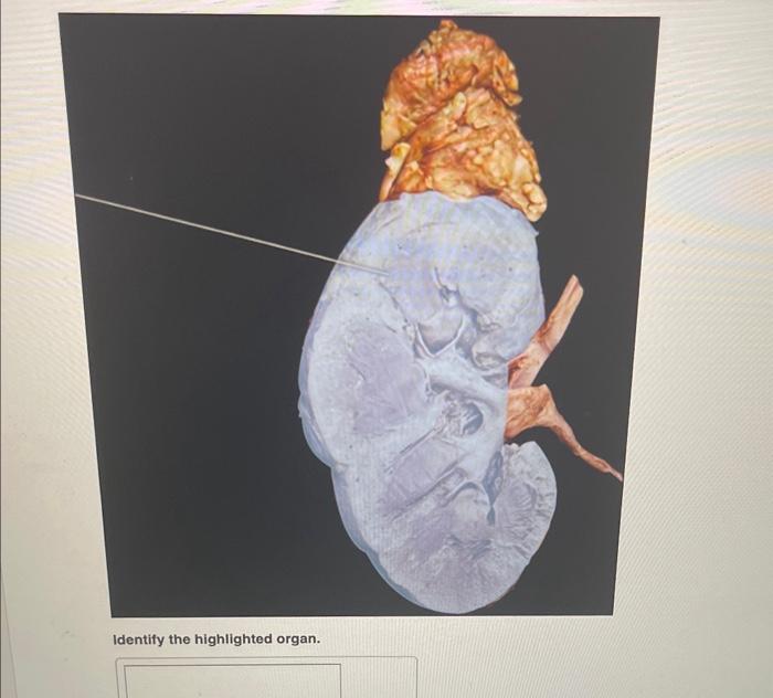 Solved Identify the highlighted organ. Identify the | Chegg.com Solved Identify the highlighted organ. Identify the | Chegg.com