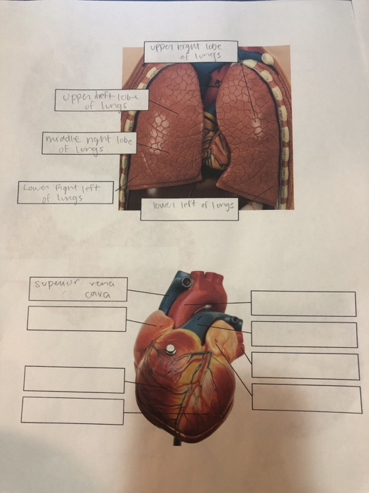 Word Bank Torso Model OAdrenal gland Aorta O Aortic | Chegg.com