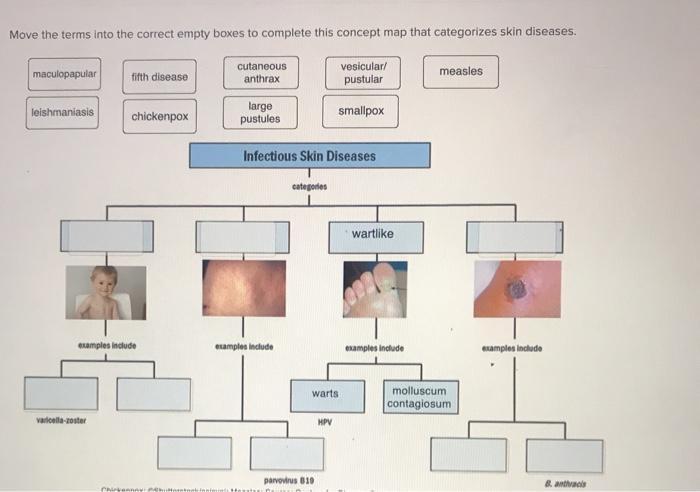 Move the terms into the correct empty boxes to | Chegg.com