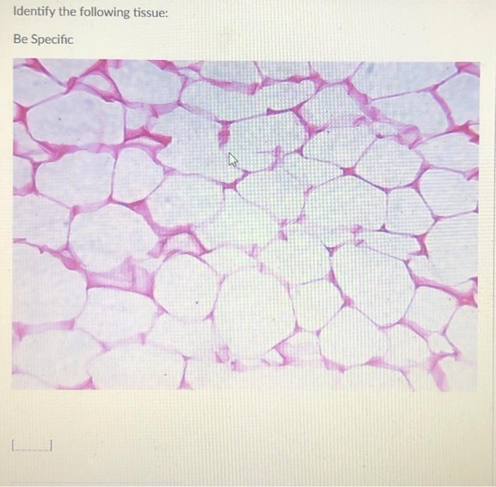 Solved Identify the following tissue: Be Specific | Chegg.com
