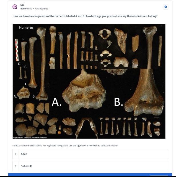 Here we have two fragments of the humerus labeled A | Chegg.com