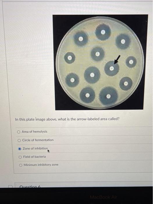 Solved In this plate image above, what is the arrow-labeled | Chegg.com