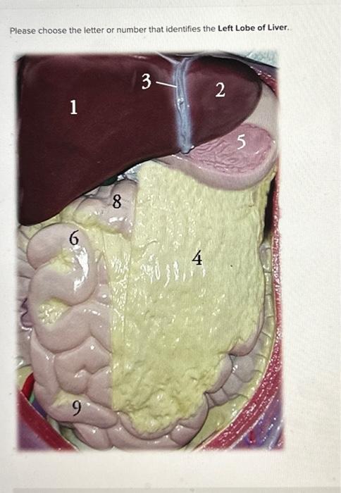 Solved Plasca rhnnce the letter or number that identifies | Chegg.com