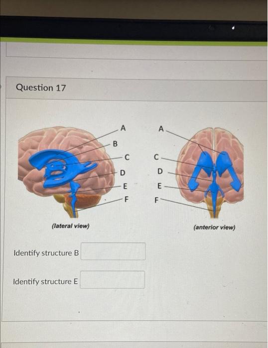Solved D Question 15 A 00 С D E E Ul Identify Structure E