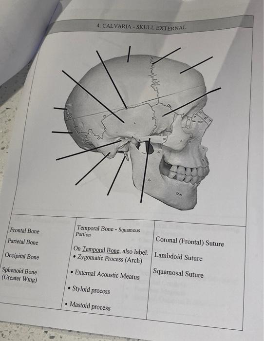 Solved 4. CALVARIA - SKULL EXTERNAL Frontal Bone Portion | Chegg.com