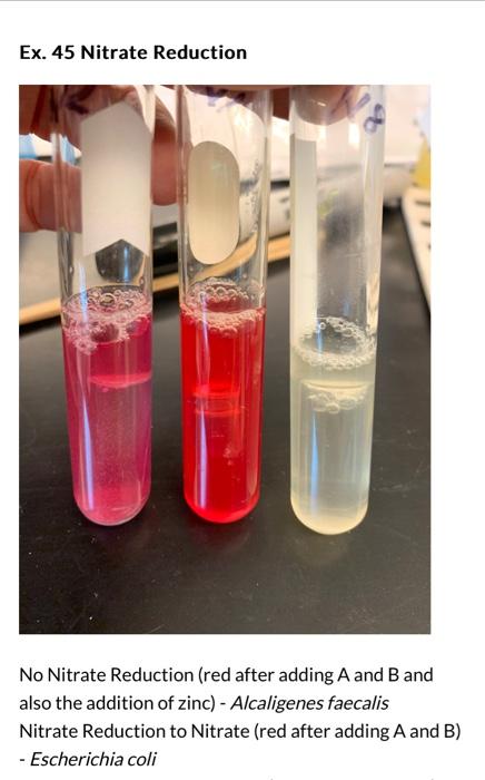 IMViC (Indole, Methyl Red, VogesProskauer, Citrate) | Chegg.com