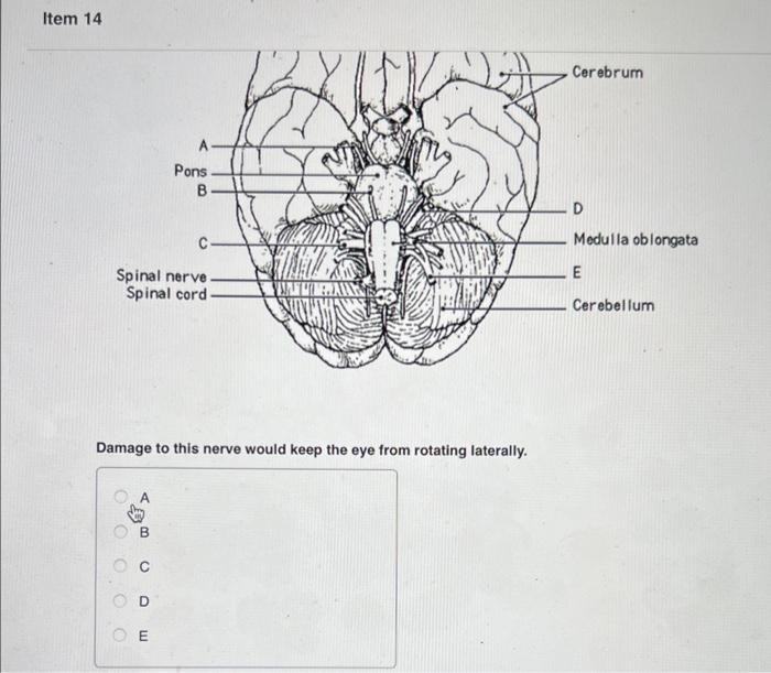Solved Damage to this nerve would keep the eye from rotating | Chegg.com