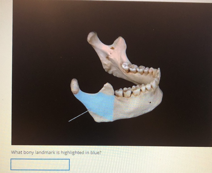 Solved What bony landmark is highlighted in blue? | Chegg.com
