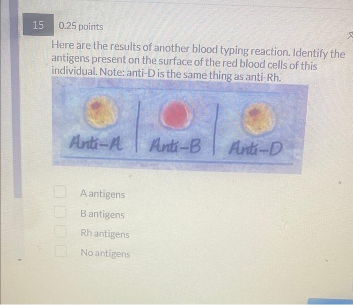 Solved Here are the results of another blood typing | Chegg.com