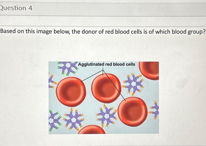 Solved Question 4 Based on this image below, the donor of | Chegg.com