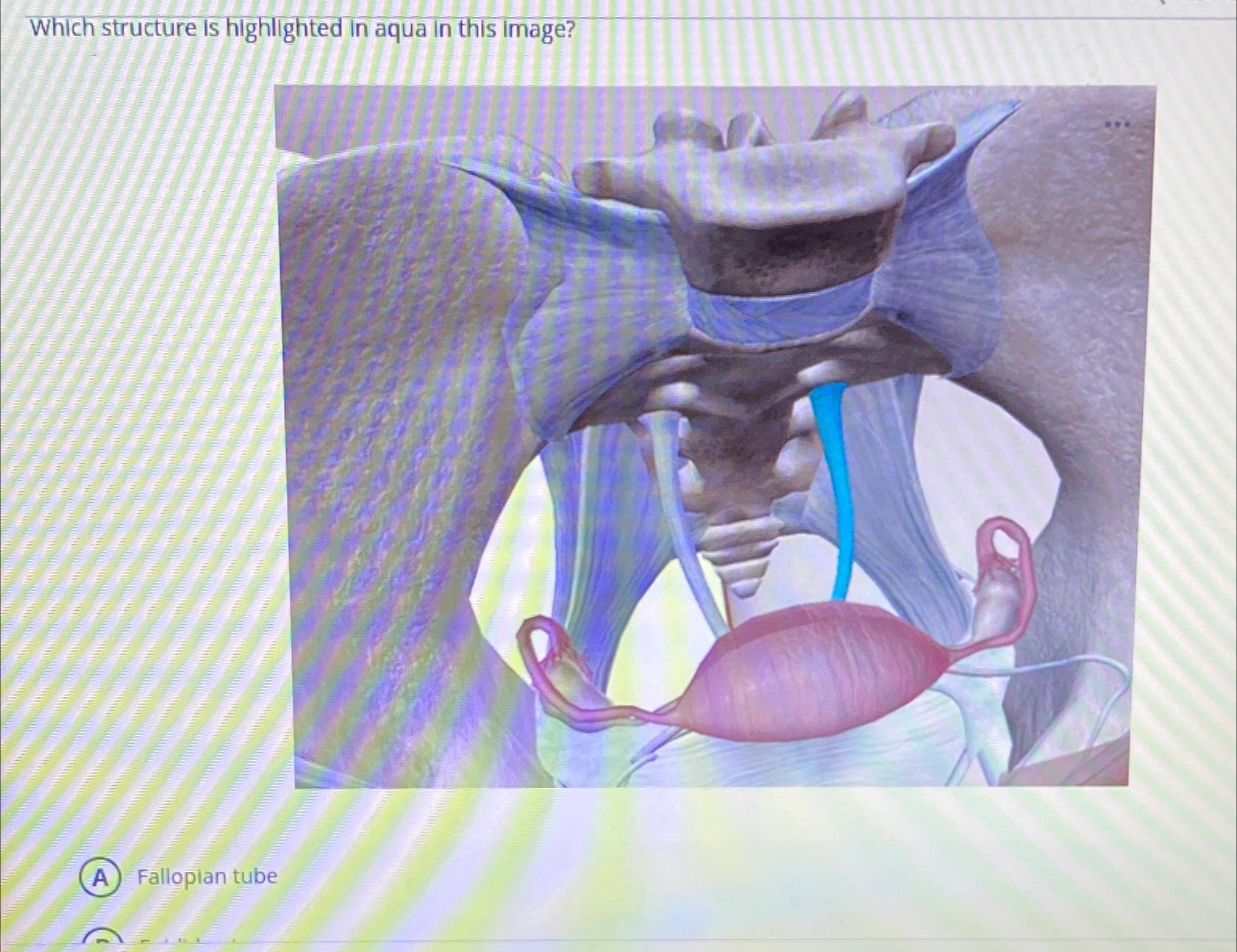 Solved Which structure is highlighted in aqua In this | Chegg.com