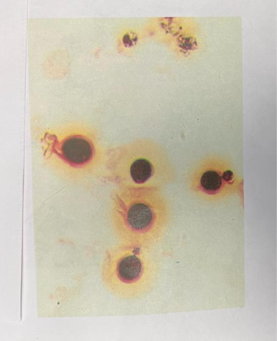 Solved identify organism from csf culture | Chegg.com