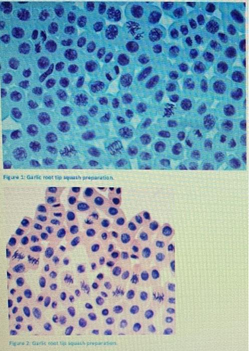 Figure 3: Garlic root tip squash preparation. a. | Chegg.com